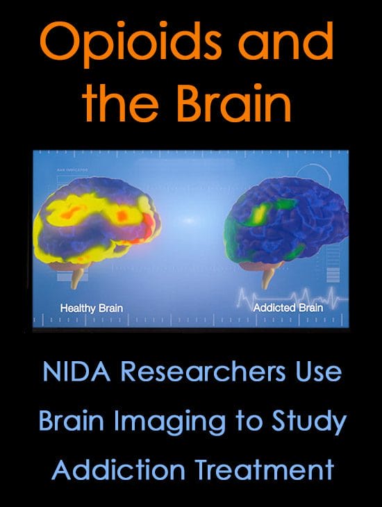 Opioid Addiction and the Brain: NIDA Researchers Use Brain Imaging to ...