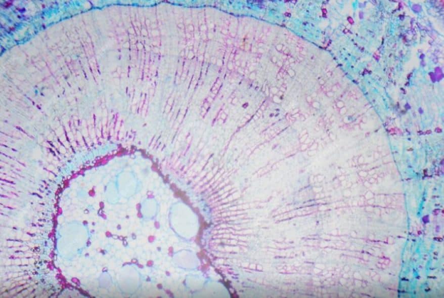TS of Stem: Monocot vs. Dicot Differences